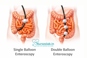Single or Double Ballon Enteroscopy: A Comprehensive Review - Nurseslab