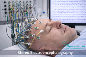 SEEG (Stereo Electroencephalography: A Comprehensive Diagnostic ...