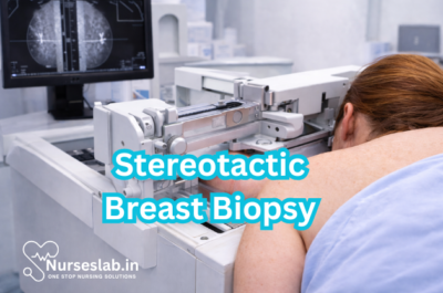 Stereotactic Breast Biopsy: A Comprehensive Overview - Nurseslab